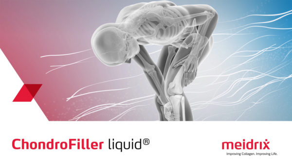 3D-animation for cartilage defects treatment | Skillmill